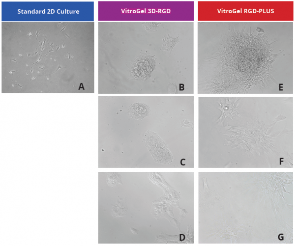 3D Cell Culture of Bone Marrow Stroma Cells (OP9) on VitroGel® Hydrogel ...