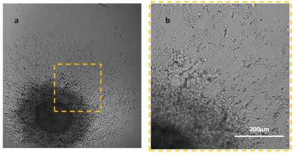 3D Spheroid Invasion Assay With the Xeno-free, Bio-Functional VitroGel ...