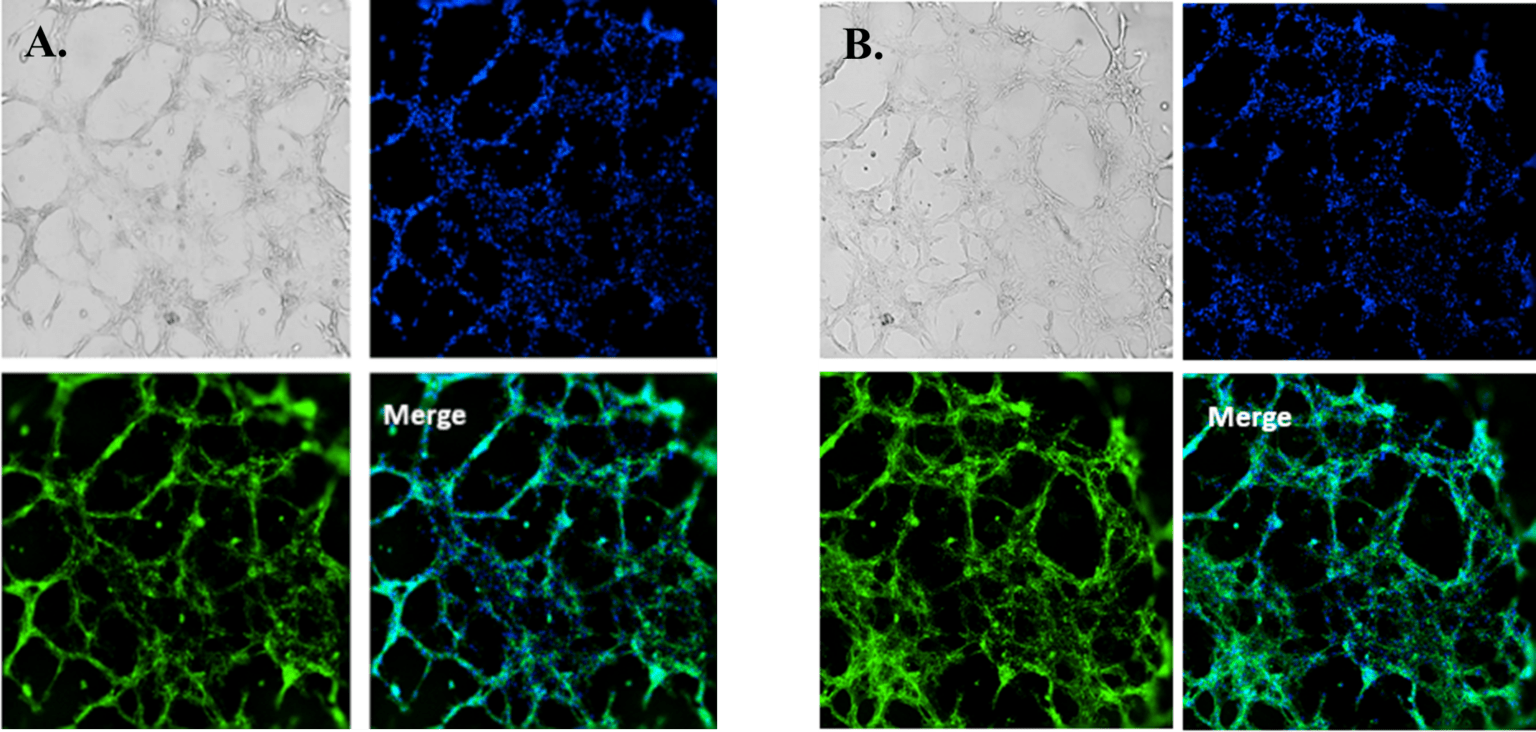 Xeno-Free Angiogenesis Cell Models Using the VitroGel System | TheWell ...