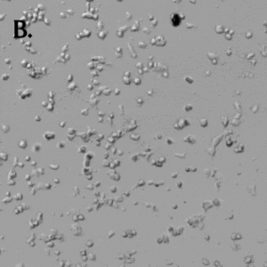 Fig-3-B-HUVEC-Tube-Formation-with-no-growth-Factor-Vitrogel-Agiogensis ...