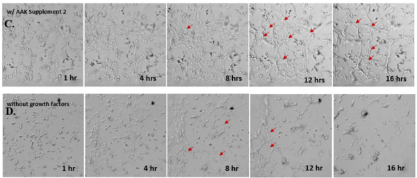 Xeno-Free Angiogenesis Cell Models Using the VitroGel System | TheWell ...