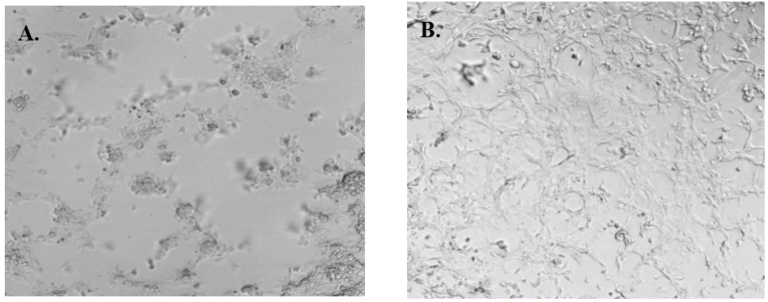 Figure 1 – VitroGel Angiogenesis Assay Kit App Note | TheWell Bioscience