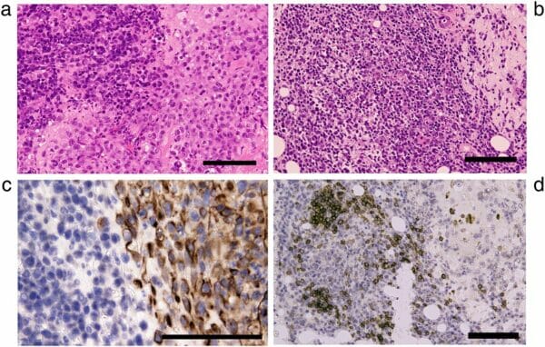 Mice Recruited to Help Fight Cancer of the Thymus | TheWell Bioscience