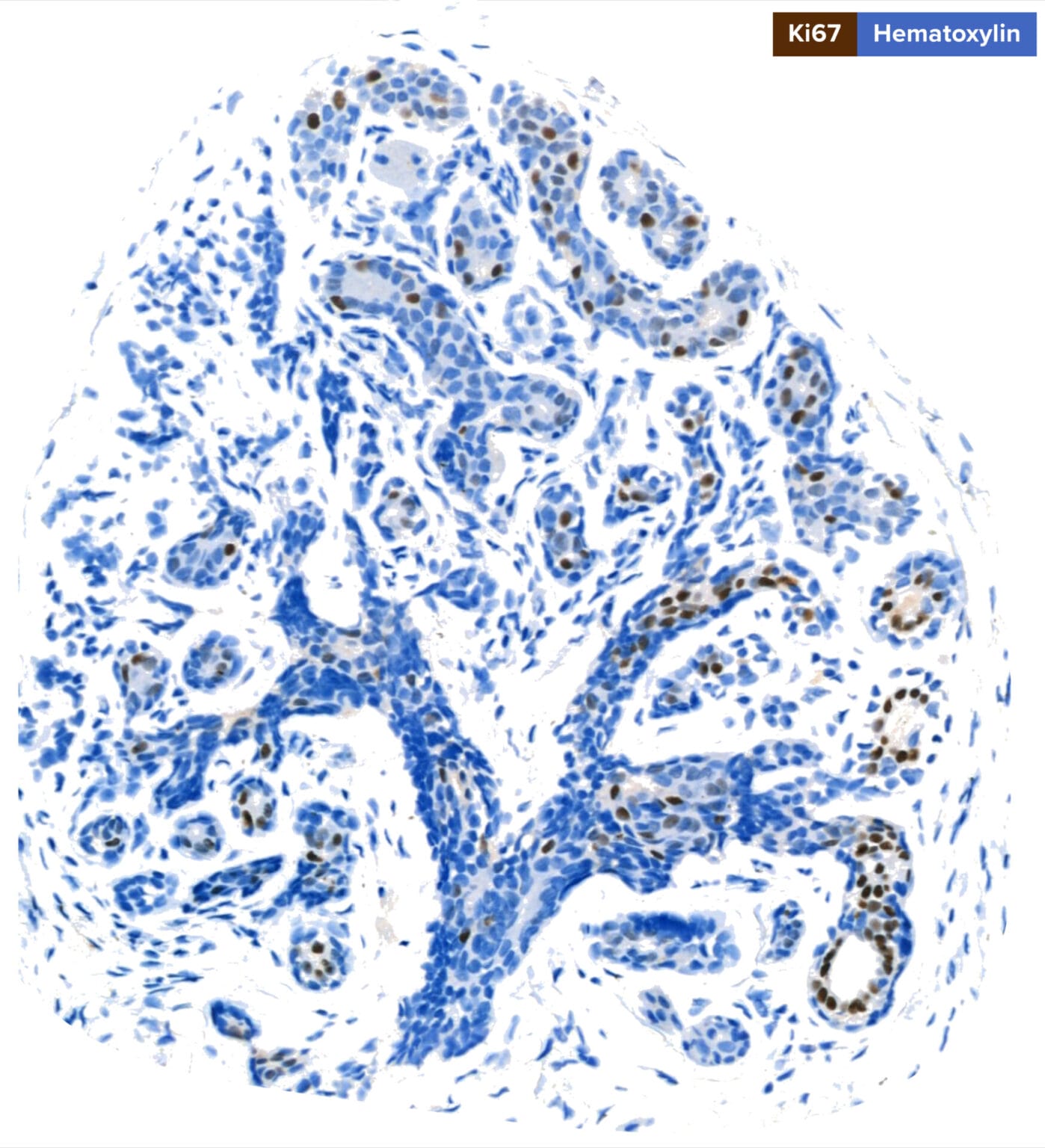 Explant Model of the Normal Human Breast | TheWell Bioscience