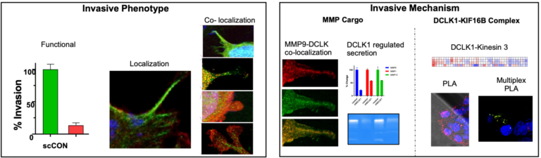Decoding New Insights into DCLK1's Role in Cancer Cell Invasion
