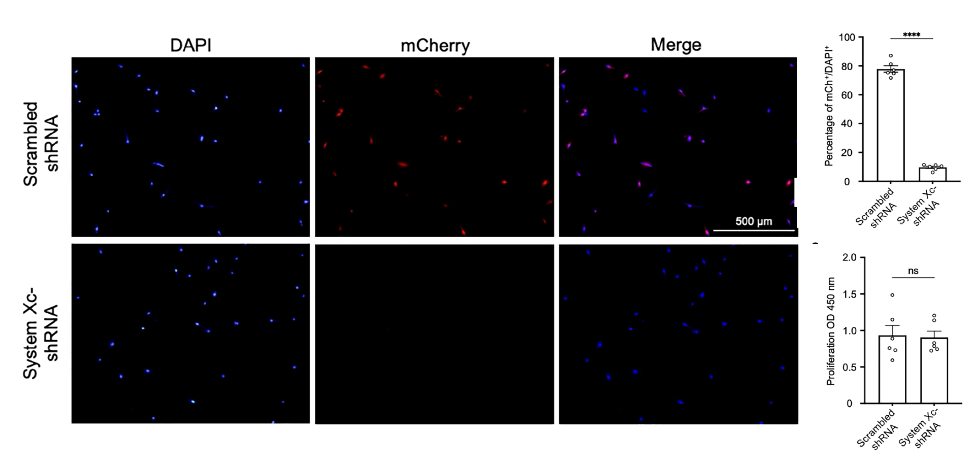 Targeting System Xc− : A Novel Approach to Inhibit Glioblastoma Invasion