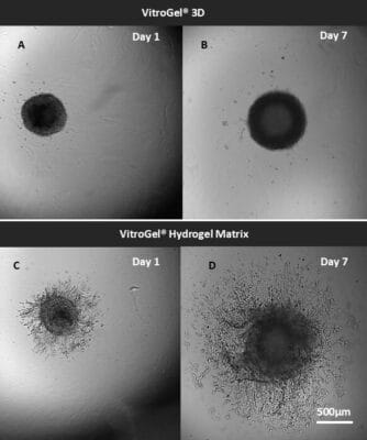 3D Spheriods Diagram Cell Invasion for web2 | TheWell Bioscience