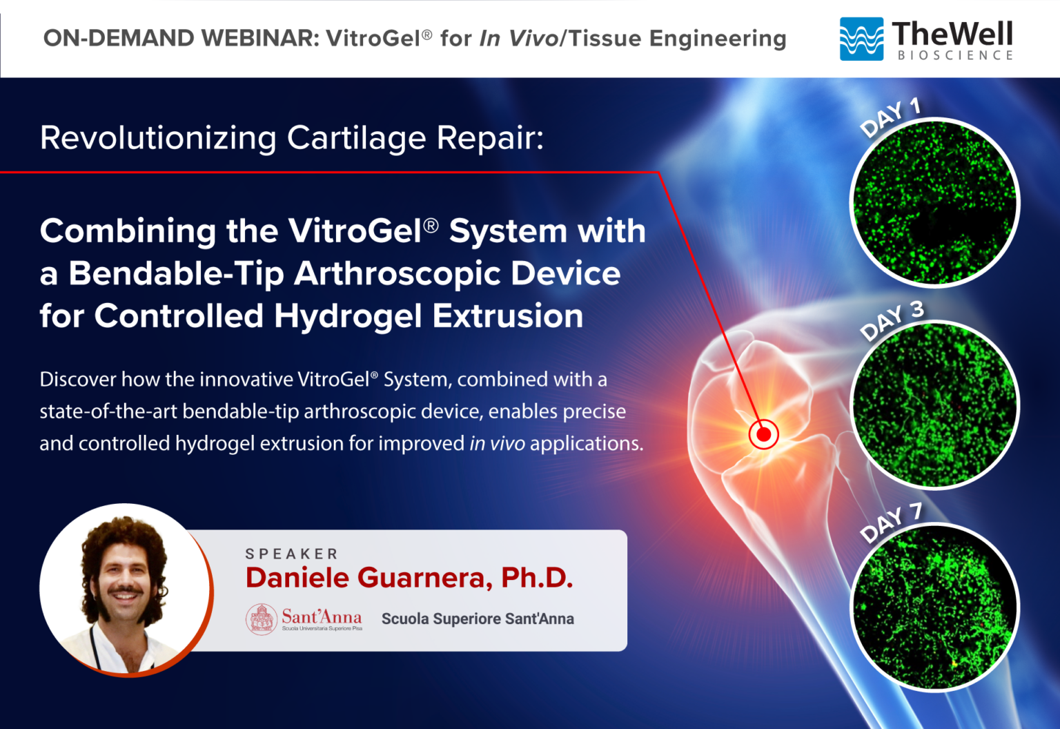 Revolutionizing Cartilage Repair: Combining the VitroGel® System with a ...