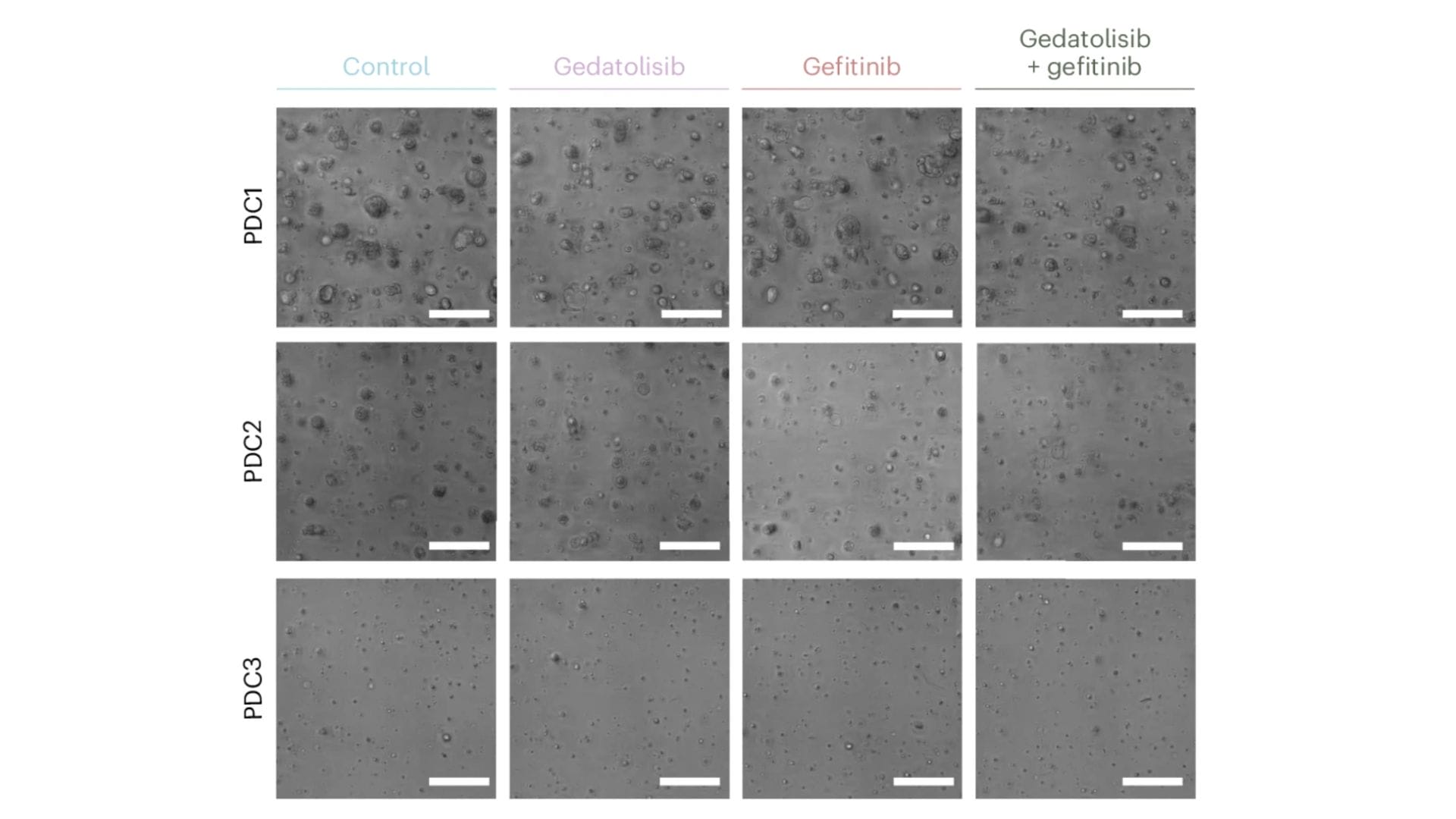 VitroGel Organoid for ovarian cancer | TheWell Bioscience