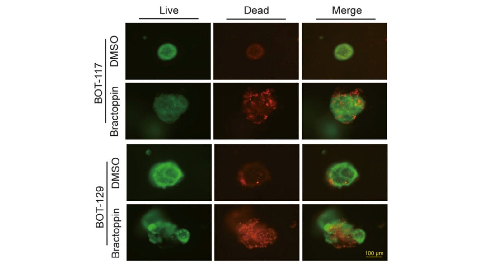 Viability Assessment in Patient-Derived Organoid Models