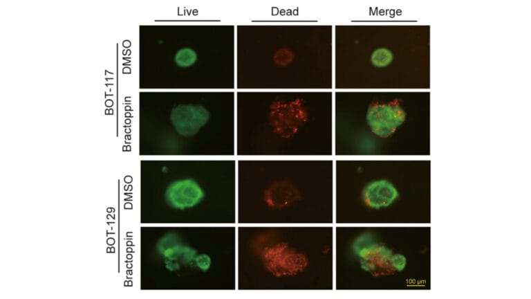 Viability Assessment in Patient-Derived Organoid Models