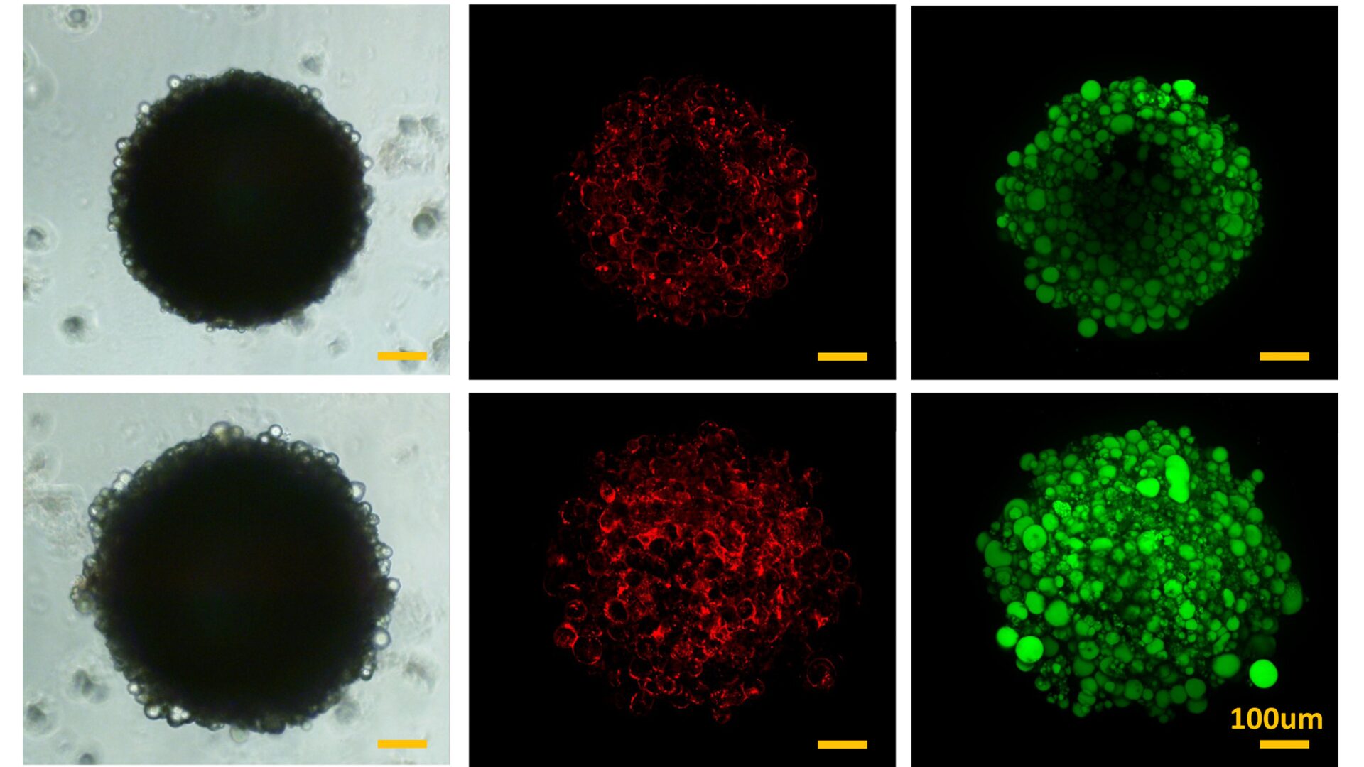 Scaffold-Free 3D Adipose Tissue Organoids: Unlocking Obesity Research ...