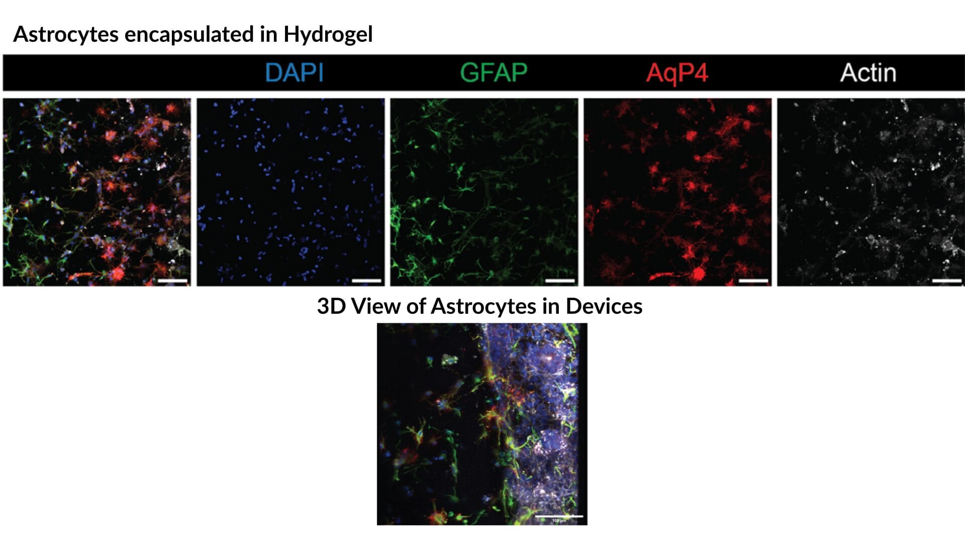 Bringing the Brain to the Bench: A Microfluidic BBB Model for Tumor ...