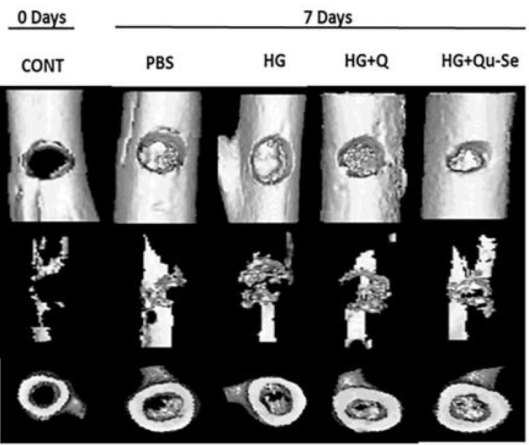 Advancing Bone Regeneration with Xeno-free VitroGel® System