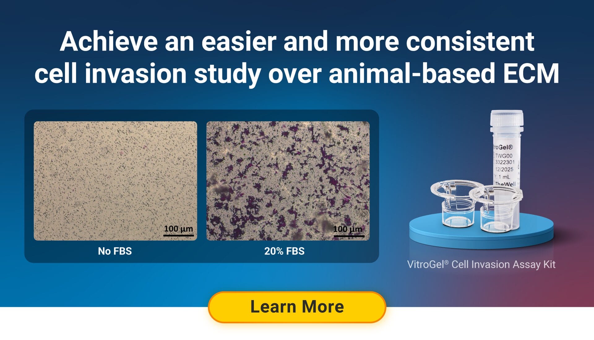 TheWell-VitroGel-Cell-Invasion-Assay-Kit-v2.2 copy (1) | TheWell Bioscience