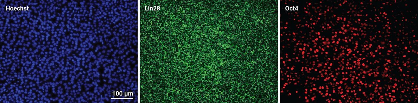 Immunostaining of IPSCs Grown in RocketCell IPSC 2 | TheWell Bioscience
