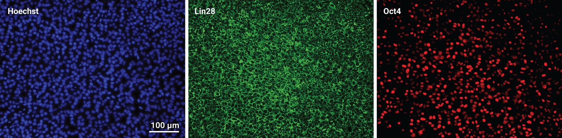 Immunostaining of IPSCs Grown in RocketCell IPSC 2 | TheWell Bioscience